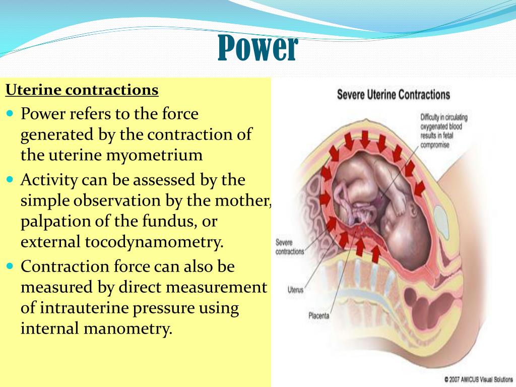 PPT - Physiology of delivery. Analgesia in labor. PowerPoint ...