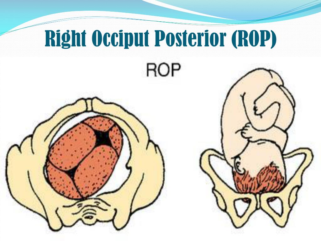 PPT - Physiology of delivery. Analgesia in labor. PowerPoint ...
