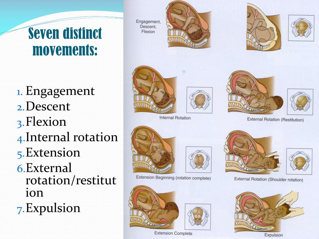 PPT - Physiology of delivery. Analgesia in labor. PowerPoint ...