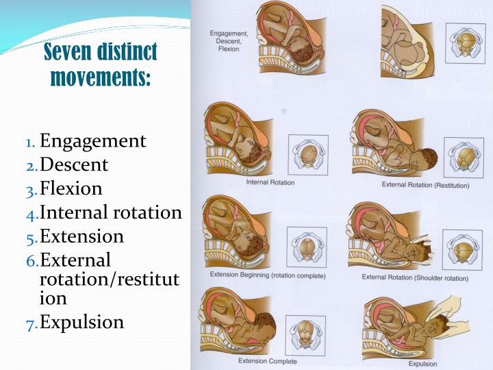 PPT - Physiology of delivery. Analgesia in labor. PowerPoint ...