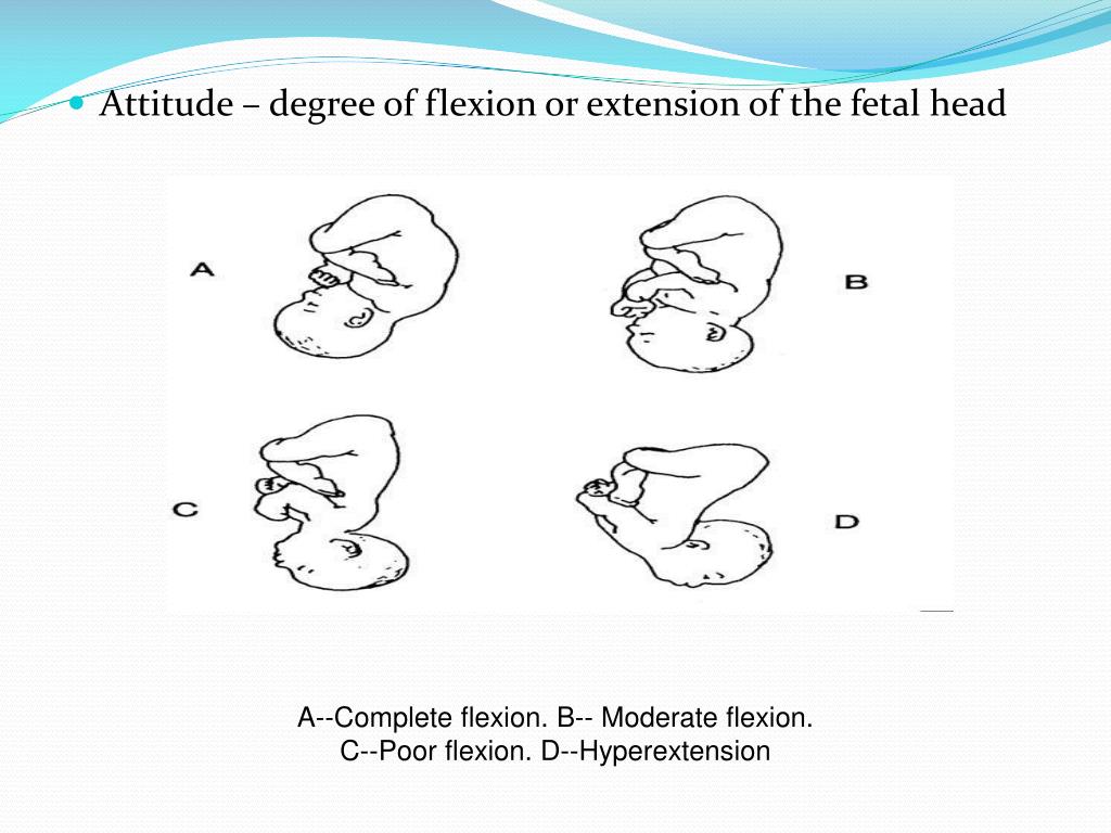 PPT - Physiology of delivery. Analgesia in labor. PowerPoint ...