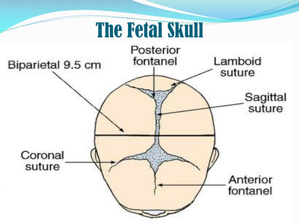 PPT - Physiology of delivery. Analgesia in labor. PowerPoint ...