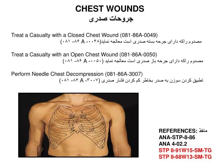 PPT - CHEST WOUNDS جروحات صدری PowerPoint Presentation, free download ...
