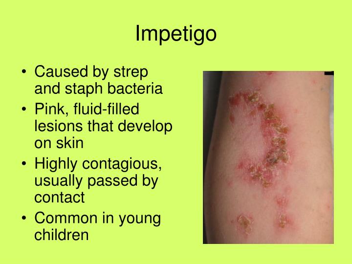 PPT - anatomy.wisc/courses/gross/ PowerPoint Presentation - ID:6450984