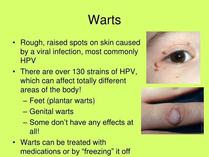 PPT - anatomy.wisc/courses/gross/ PowerPoint Presentation - ID:6450984