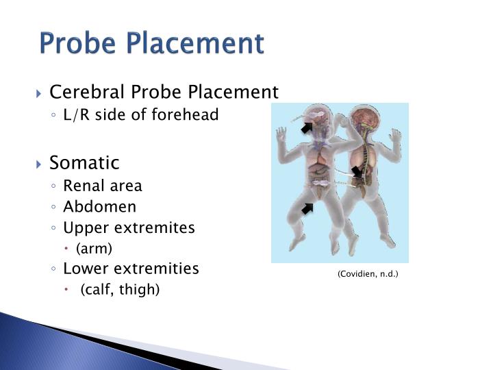 PPT - Near-Infrared Spectroscopy (NIRS) Monitoring PowerPoint ...