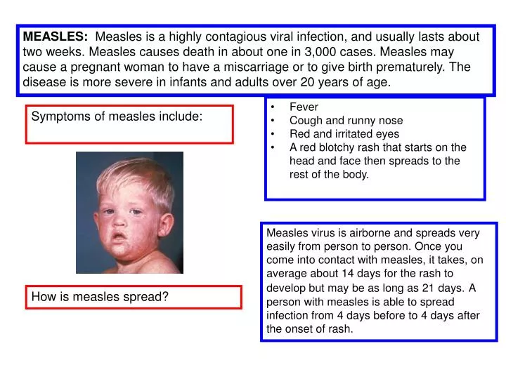 PPT - Symptoms of measles include: PowerPoint Presentation, free ...