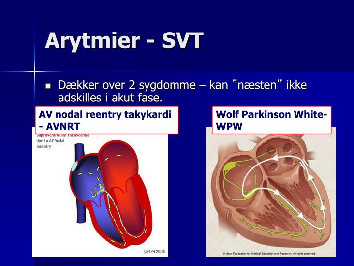 PPT - EKG undervisning PowerPoint Presentation - ID:6494617