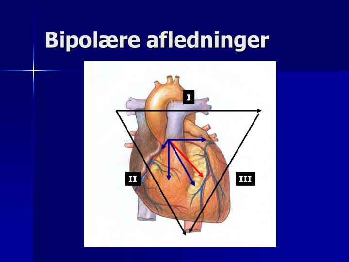 PPT - EKG undervisning PowerPoint Presentation - ID:6494617