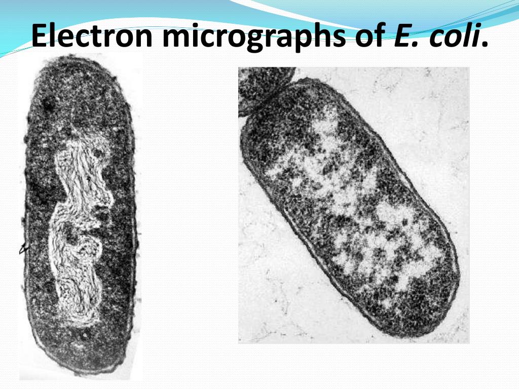 PPT - 2.2 Prokaryotic Cells PowerPoint Presentation, free download - ID ... PPT - 2.2 Prokaryotic Cells PowerPoint Presentation, free download - ID ...
