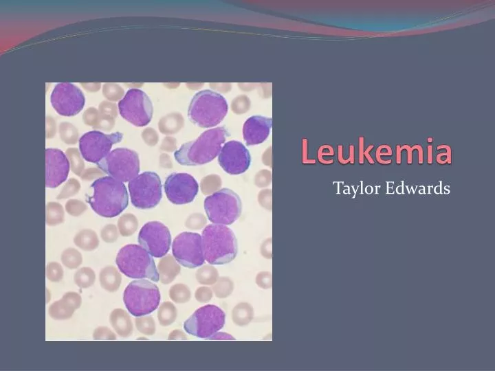 PPT - Leukemia PowerPoint Presentation, free download - ID:6499963