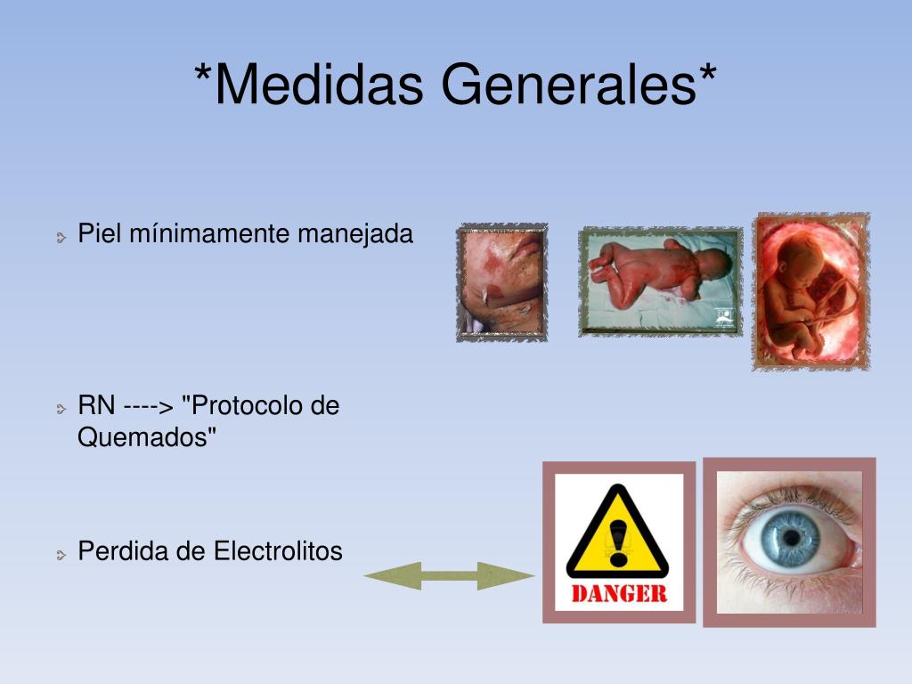 PPT - Síndrome de la Piel Escaldada Estafilocócica PowerPoint ...