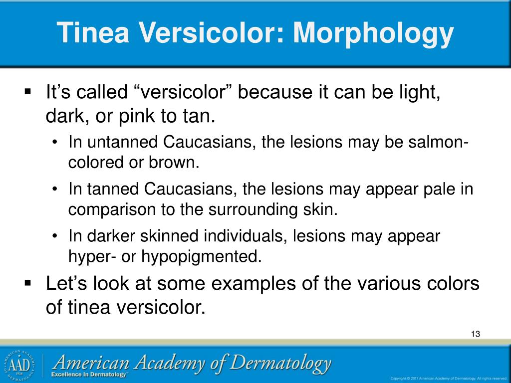 PPT - Adult Cutaneous Fungal Infections 2: Yeasts PowerPoint ...