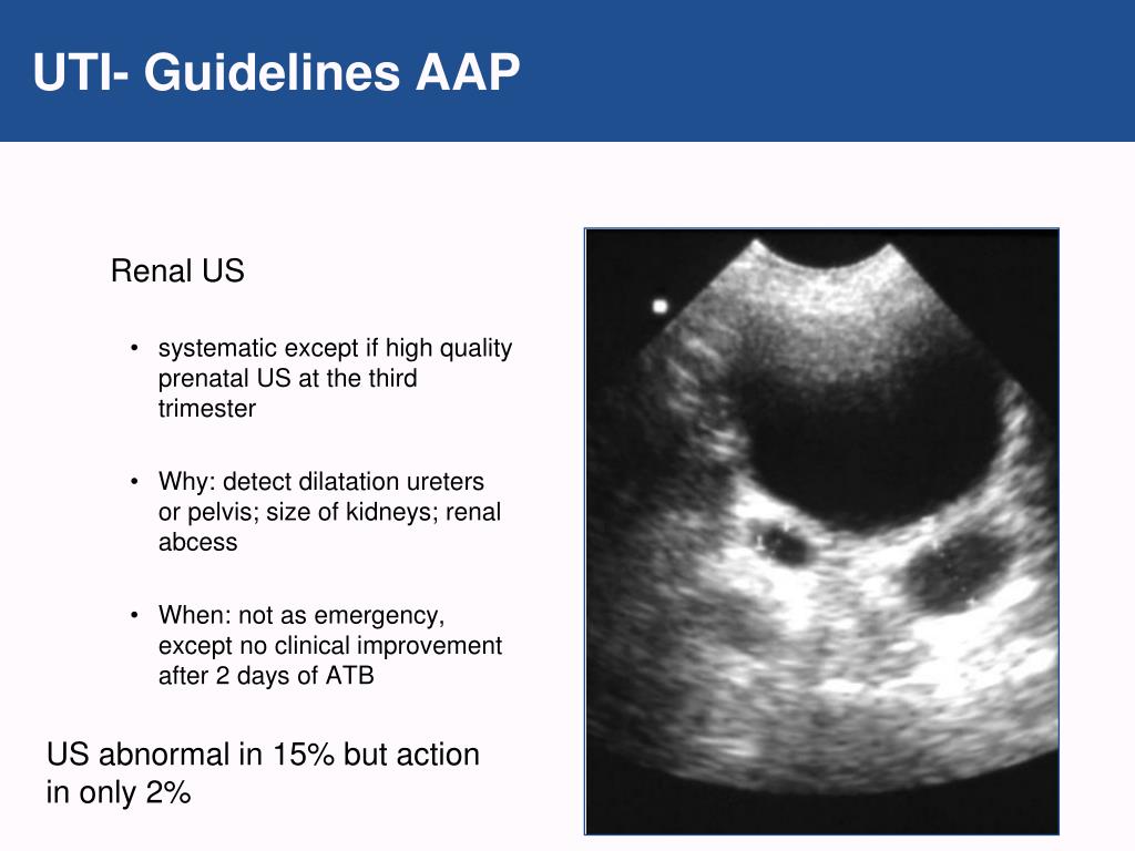 PPT - Urinary tract infections in children What investigations ...