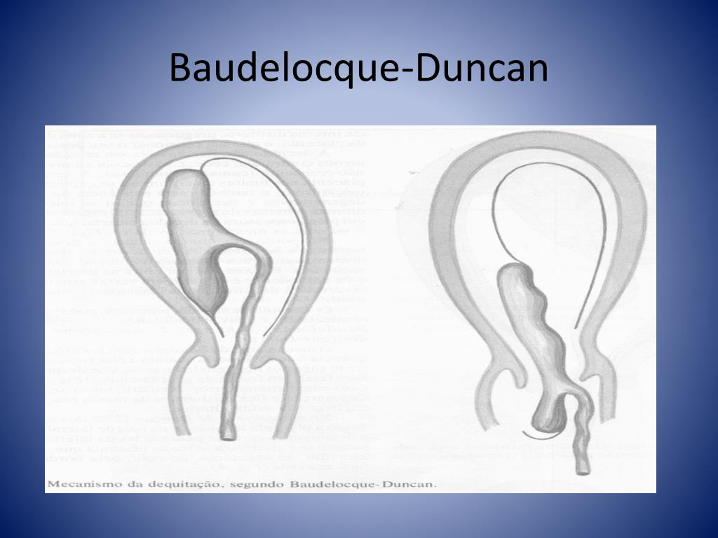 PPT - Hospital Universitário Materno Infantil PowerPoint Presentation ...