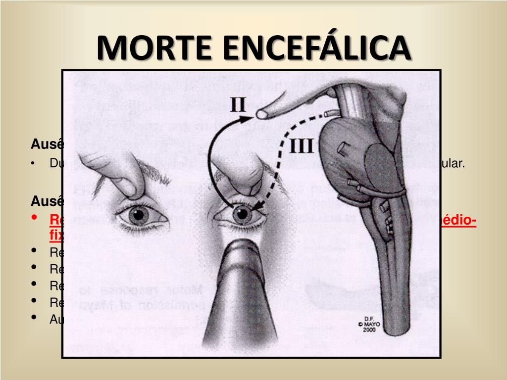 Ppt Morte EncefÁlica E DoaÇÃo De ÓrgÃos Powerpoint Presentation Id