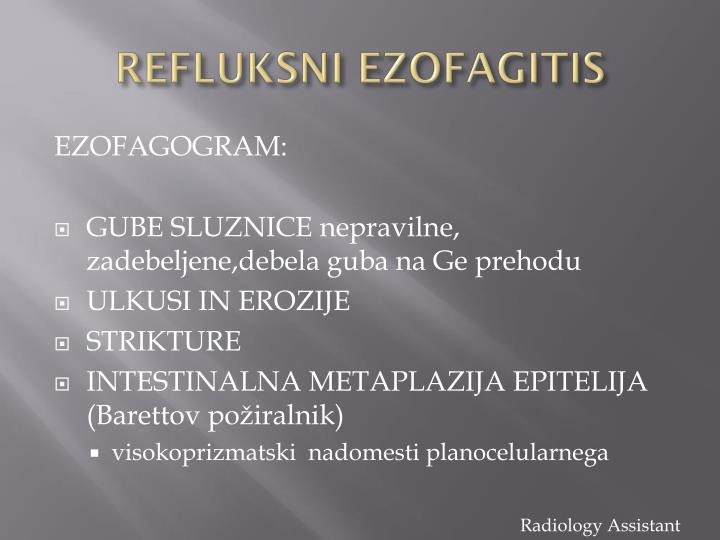 PPT - GERB gastro-ezofagealna refluksna bolezen PowerPoint Presentation ...
