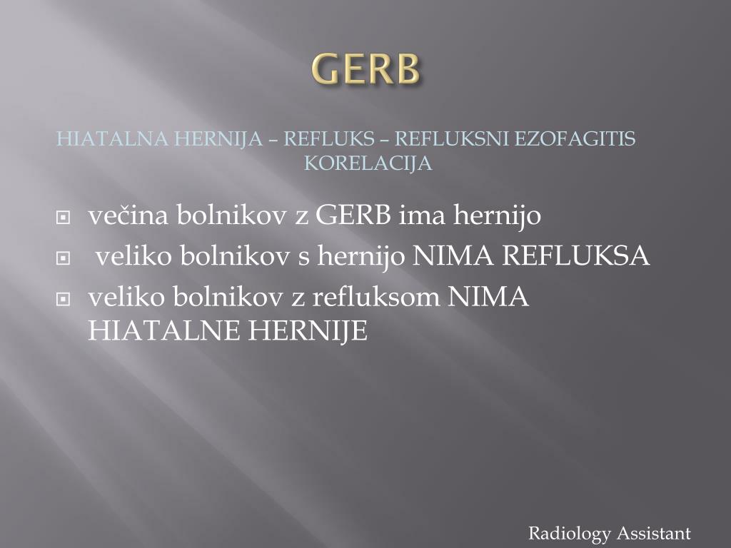 PPT - GERB gastro-ezofagealna refluksna bolezen PowerPoint Presentation ...