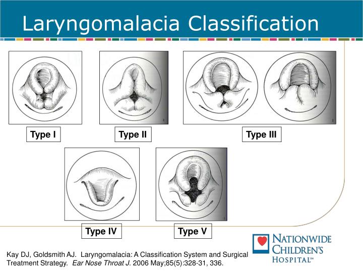 PPT - Treatment of Pediatric Airway Disorders: Beyond Tracheostomy ...