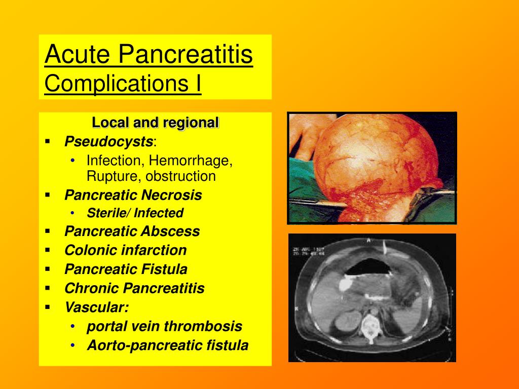 PPT - Pancreatic Diseases Dr A. Badrek-Amoudi FRCS PowerPoint ...