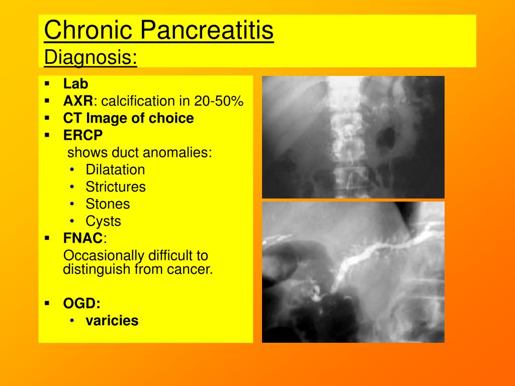 PPT - Pancreatic Diseases Dr A. Badrek-Amoudi FRCS PowerPoint ...