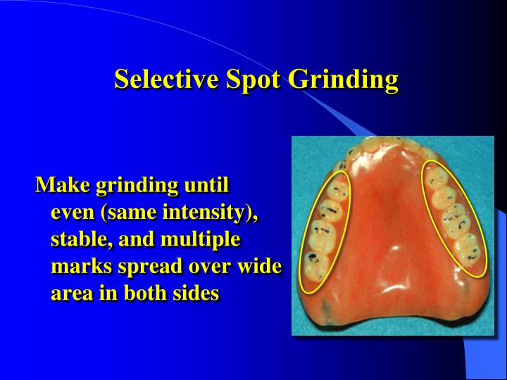 PPT - Denture Placement & Occlusion Correction PowerPoint Presentation - ID:6523214