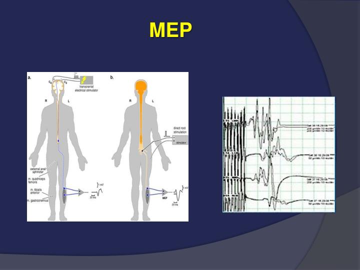 PPT - Intraoperative Monitoring PowerPoint Presentation - ID:6524235