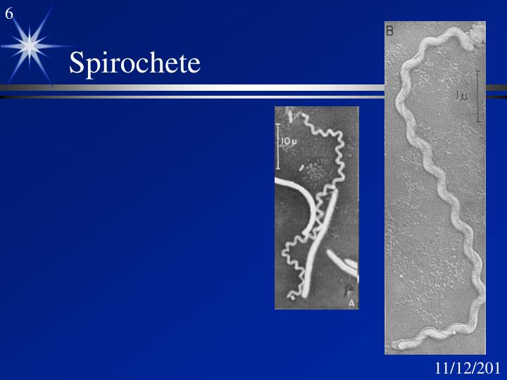 PPT - Spirochaetes PowerPoint Presentation - ID:6524656