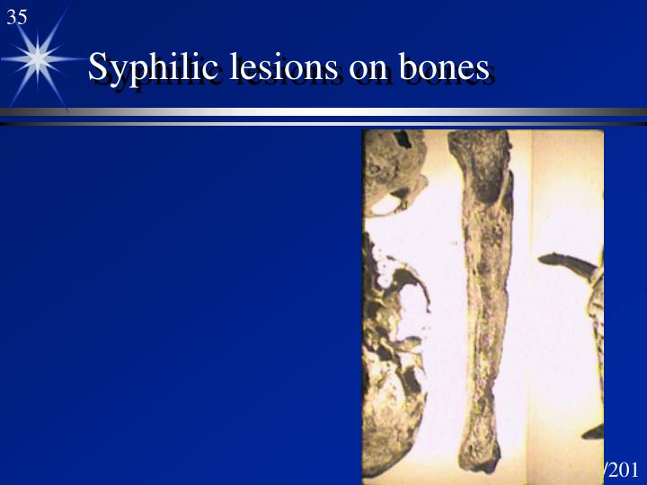 PPT - Spirochaetes PowerPoint Presentation - ID:6524656