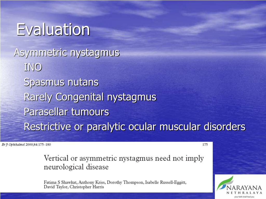 PPT - Management of Nystagmus – the Ophthalmologist’s perspective ...