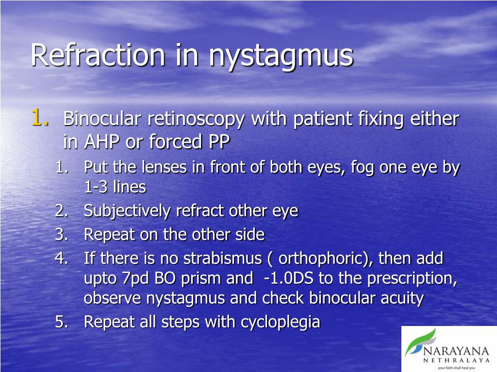 PPT - Management of Nystagmus – the Ophthalmologist’s perspective ...