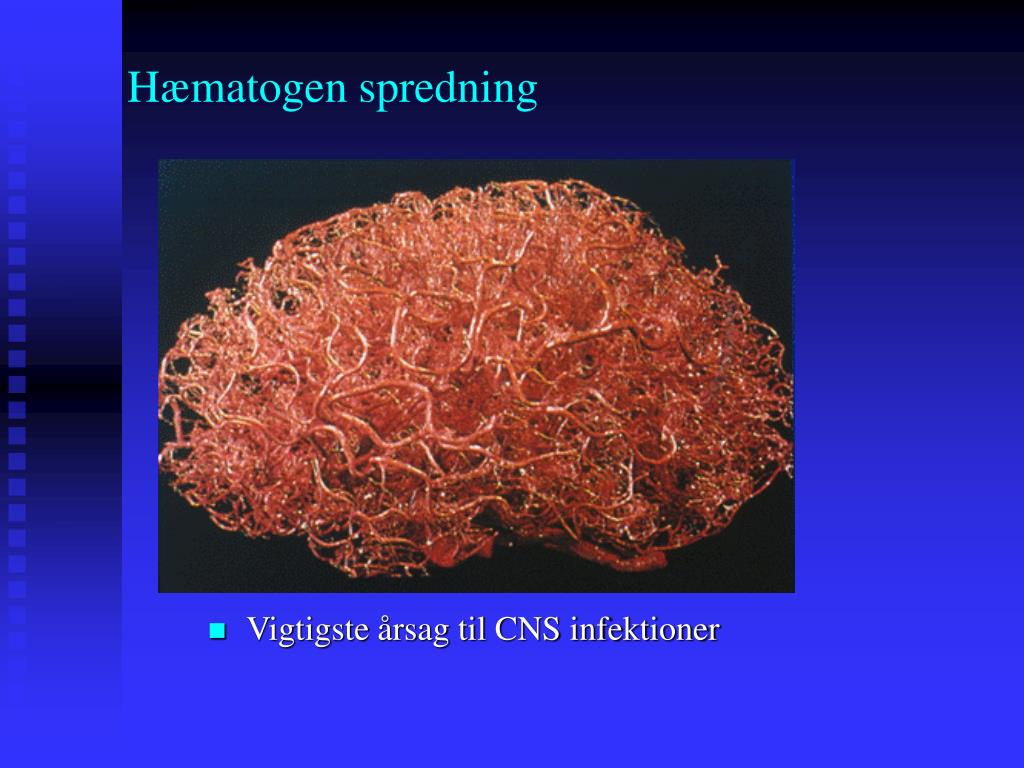 PPT - Neuroanatomiske forhold af betydning for neuroinfektioner ...
