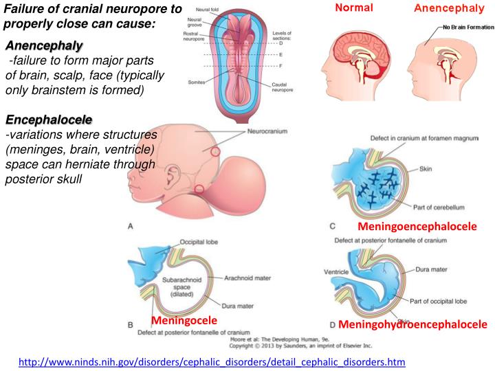 PPT - Vertebral Column- 4 th Week Onward Sept 29 th , 2014 PowerPoint ...