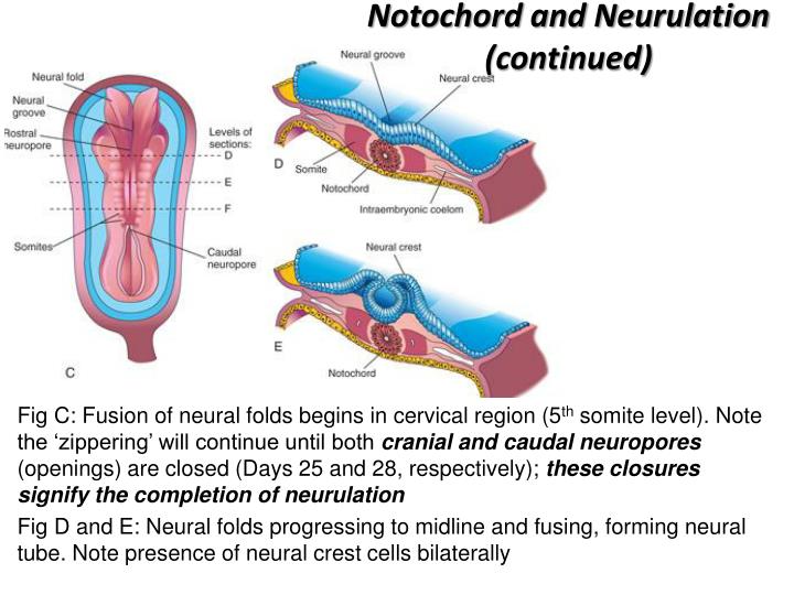 PPT - Vertebral Column- 4 th Week Onward Sept 29 th , 2014 PowerPoint ...