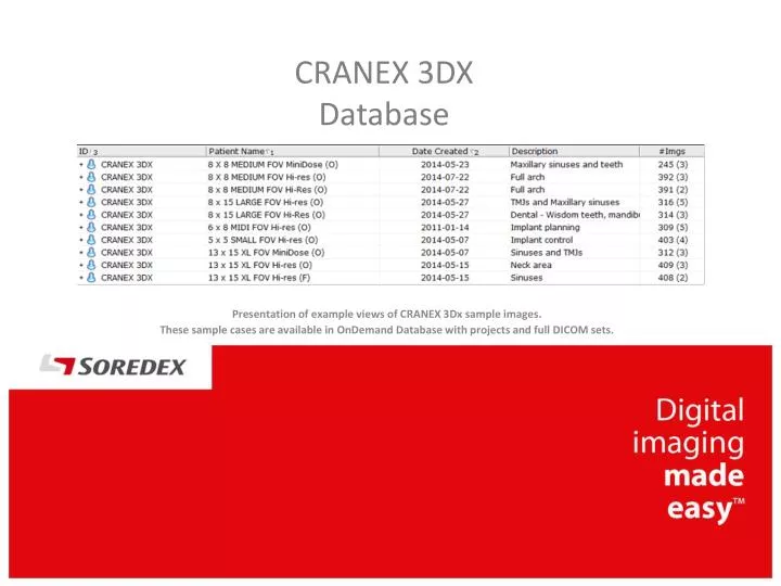 PPT - CRANEX 3DX Database PowerPoint Presentation, free download - ID ...