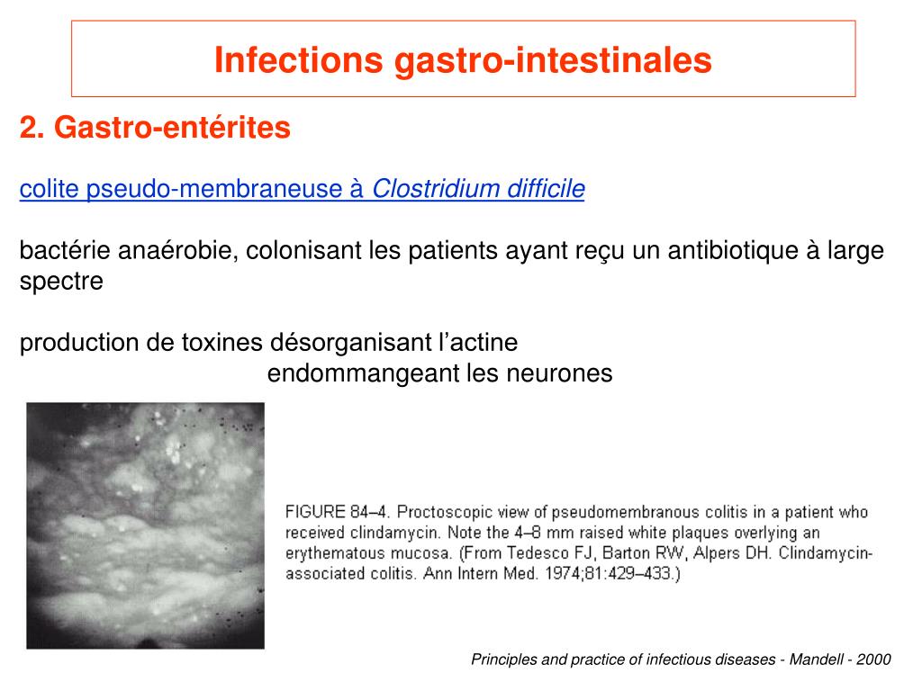 PPT - Infections gastro-intestinales PowerPoint Presentation, free ...