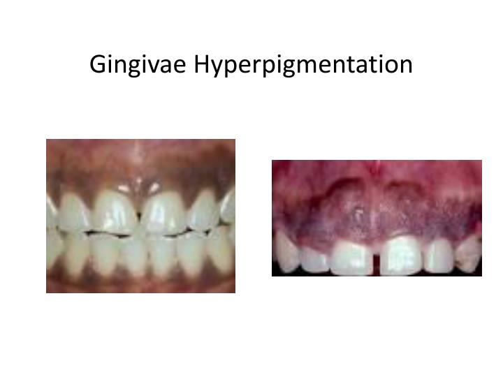 PPT - Dermatology in Individuals with SKIN OF COLOR PowerPoint ...