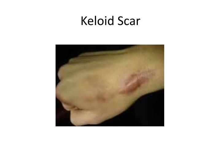 PPT - Dermatology in Individuals with SKIN OF COLOR PowerPoint ...