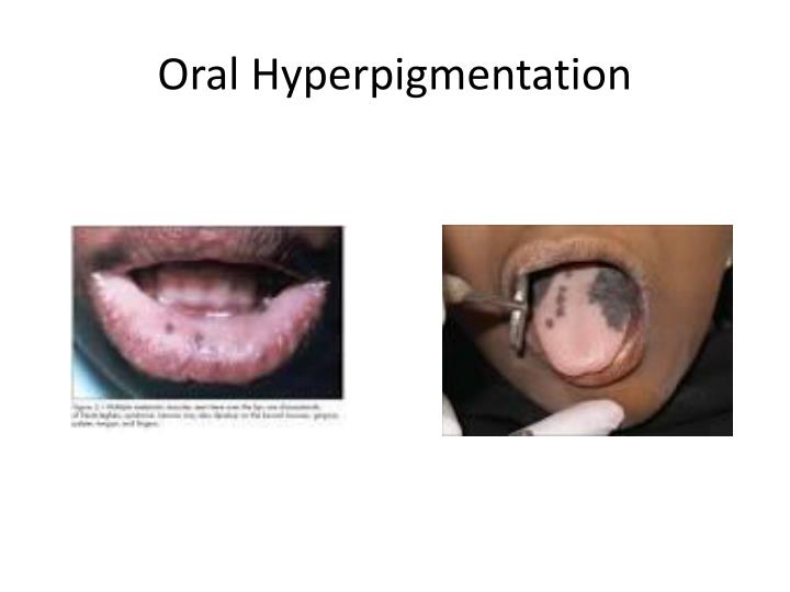 PPT - Dermatology in Individuals with SKIN OF COLOR PowerPoint ...