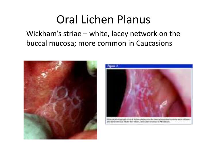 PPT - Dermatology in Individuals with SKIN OF COLOR PowerPoint ...