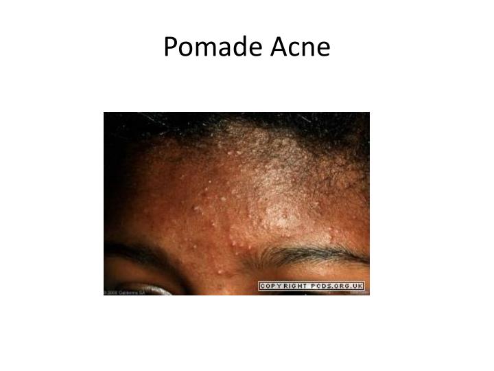 PPT - Dermatology in Individuals with SKIN OF COLOR PowerPoint ...