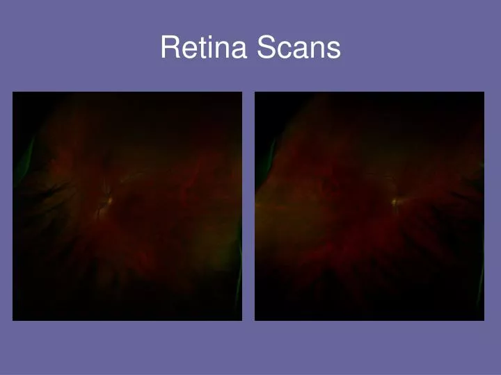 PPT - Retina Scans PowerPoint Presentation, free download - ID:6544577