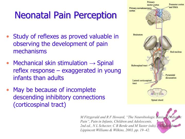 PPT - Pediatric Pain Management PowerPoint Presentation - ID:6554644