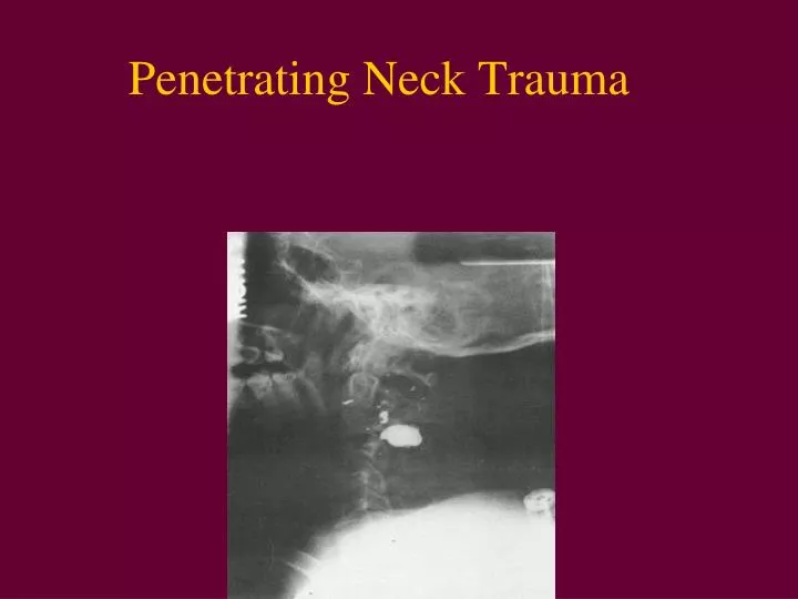 PPT - Penetrating Neck Trauma PowerPoint Presentation, free download ...