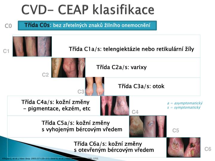 PPT - Diagnostika a léčba onemocnění periferních žil PowerPoint ...