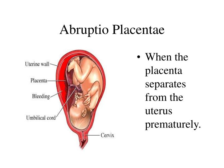 PPT - Placenta PowerPoint Presentation - ID:6569468