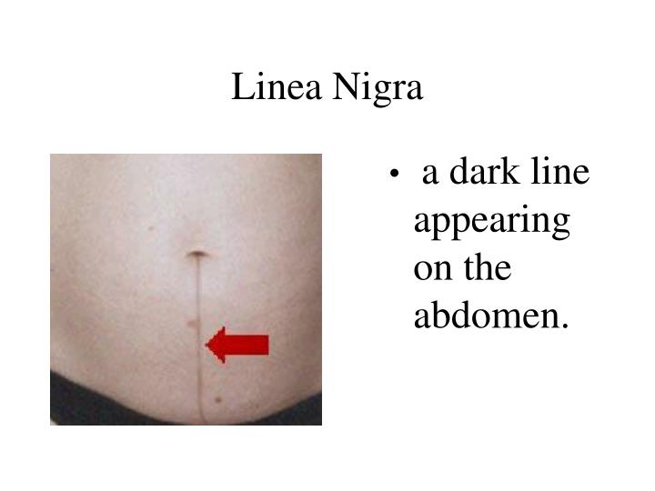 PPT - Placenta PowerPoint Presentation - ID:6569468