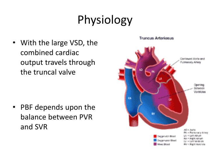 PPT - Truncus Arteriosus PowerPoint Presentation - ID:6569500