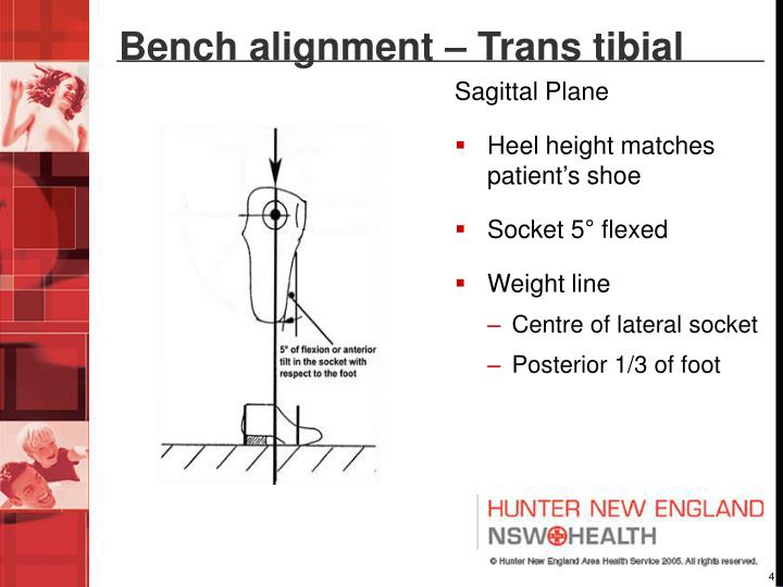 PPT - Prosthetic Gait Deviations PowerPoint Presentation - ID:6571061