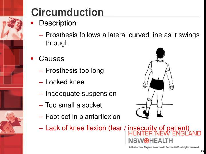PPT - Prosthetic Gait Deviations PowerPoint Presentation - ID:6571061